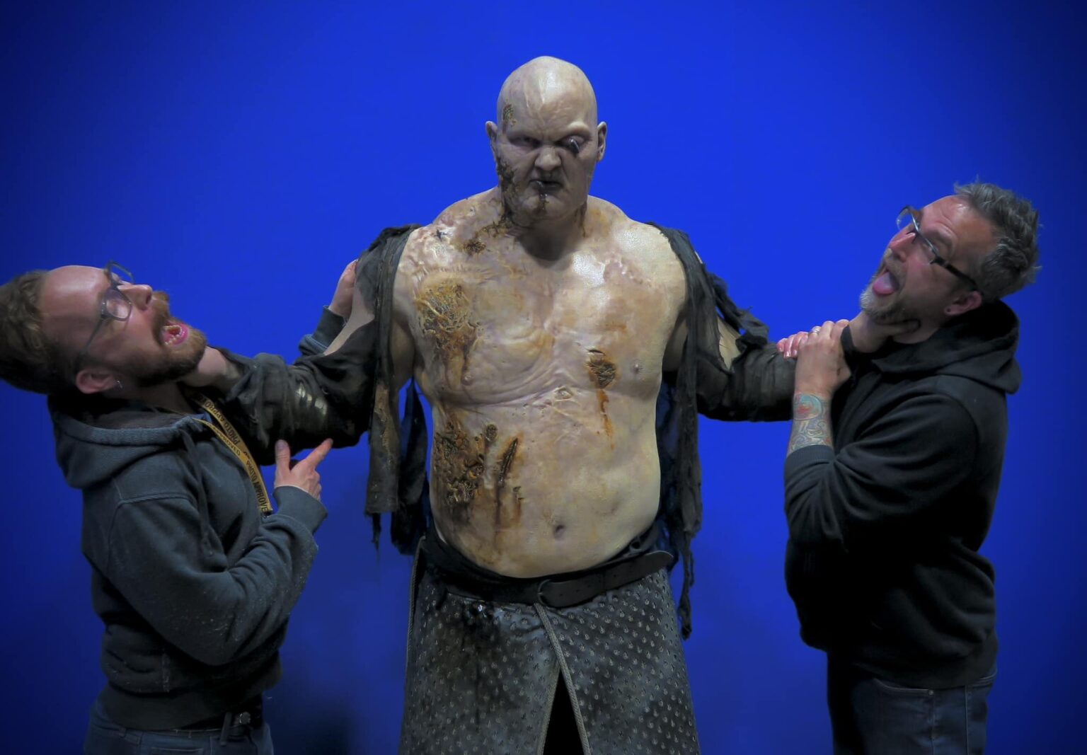 Game of Thrones actor, boxer and Strongmen Thor Bjornsson Has a Medical ...