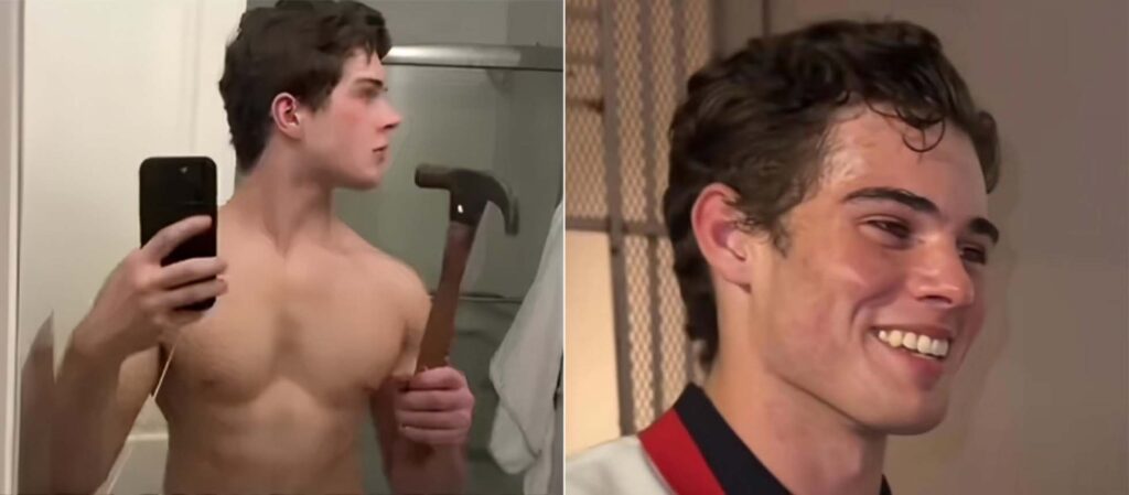 Influencer who got on TRT at 14 also does “bone smashing” to make his ...