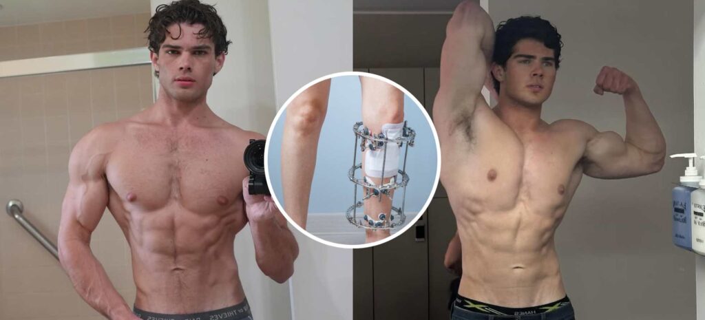 Influencer who sterilized himself with TRT at age 14 plans to pay $100k ...