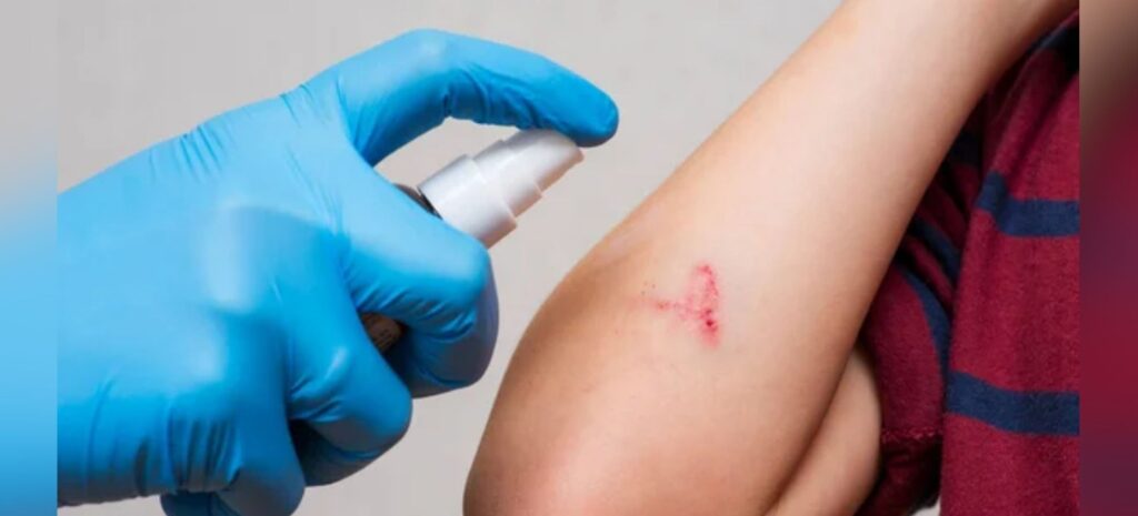 Scientists Develop Spray-On Powder That Instantly Seals Wounds
