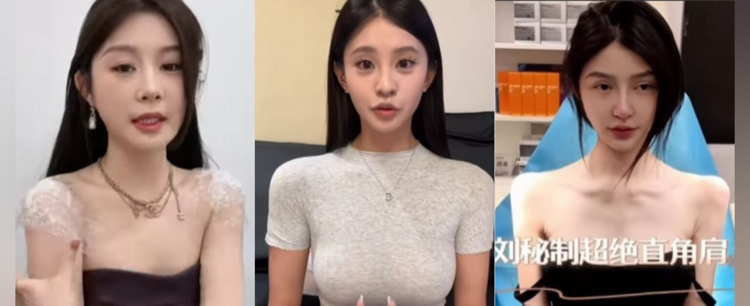 Chinese Influencers Are Surgically Chasing 90-Degree Shoulders As The ...